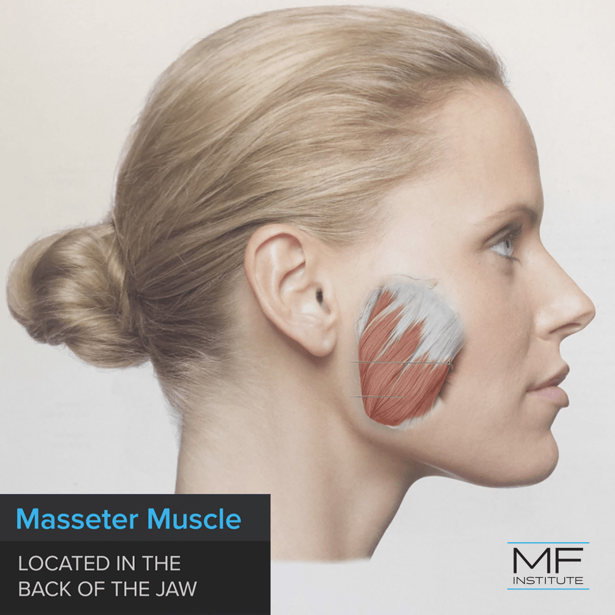 Forget Buccal Fat Removal: Start With BOTOX® for Face Slimming (Updated ...