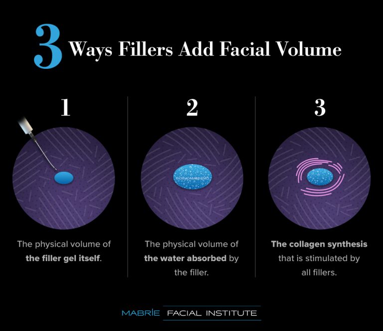 How Long Do Dermal Fillers Last? The Definitive Guide