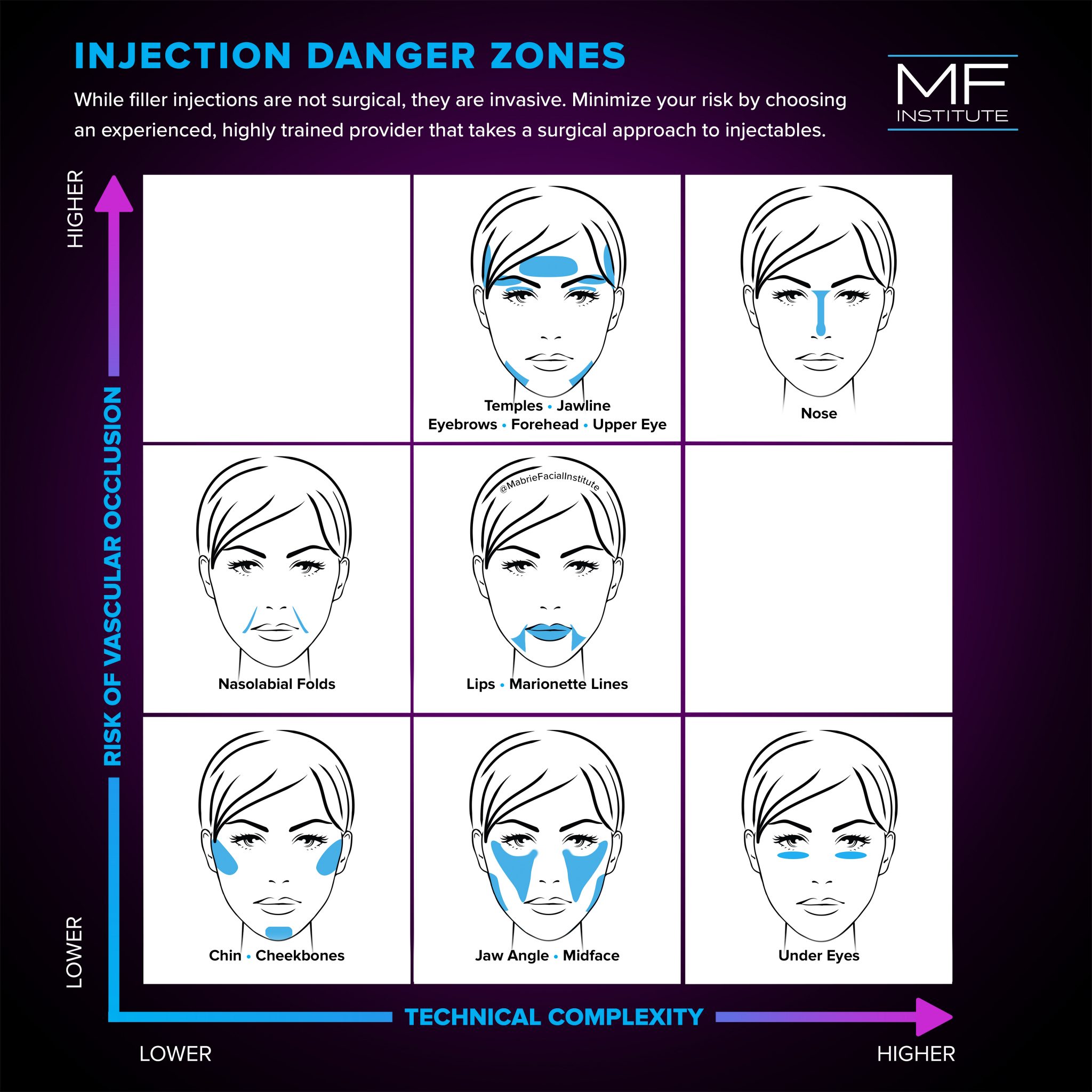 Choosing an Expert Injector in San Francisco | Mabrie Facial Institute