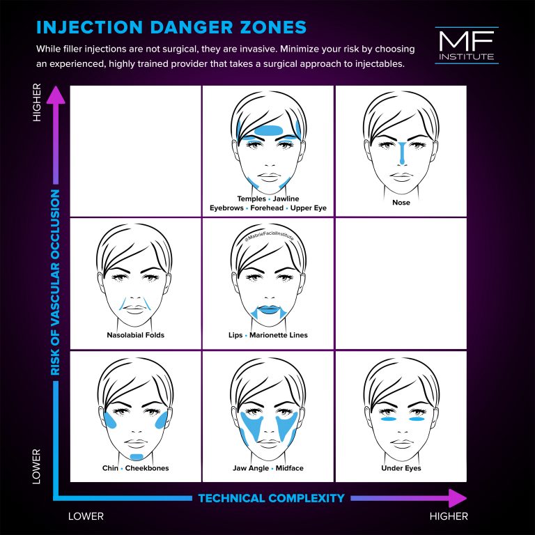 Choosing an Expert Injector in San Francisco | Mabrie Facial Institute