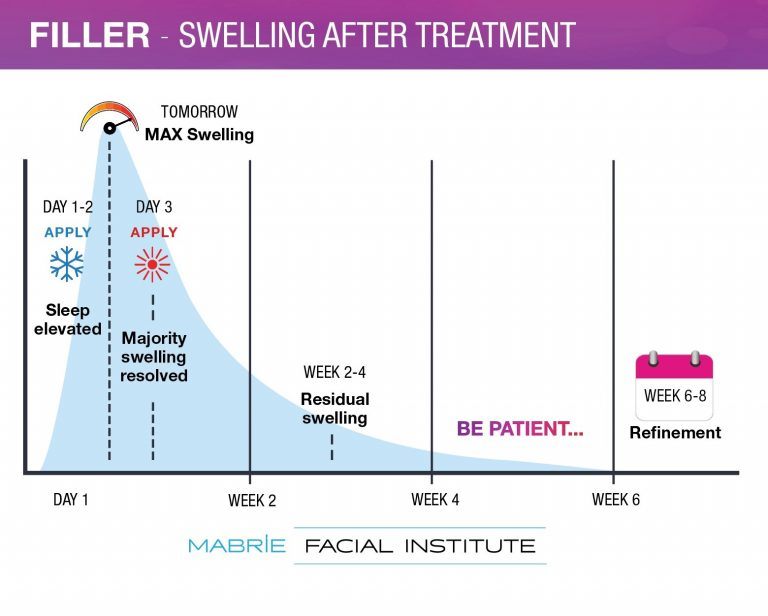 Under Eye/Tear Trough Filler: Everything You Need To Know – Mabrie ...