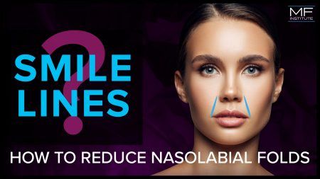 Filler for Nasolabial Folds in San Francisco – Mabrie Facial Institute
