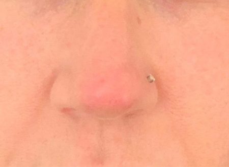 BOTOX® and Dermal Filler Before and Aftercare Instructions | Mabrie ...