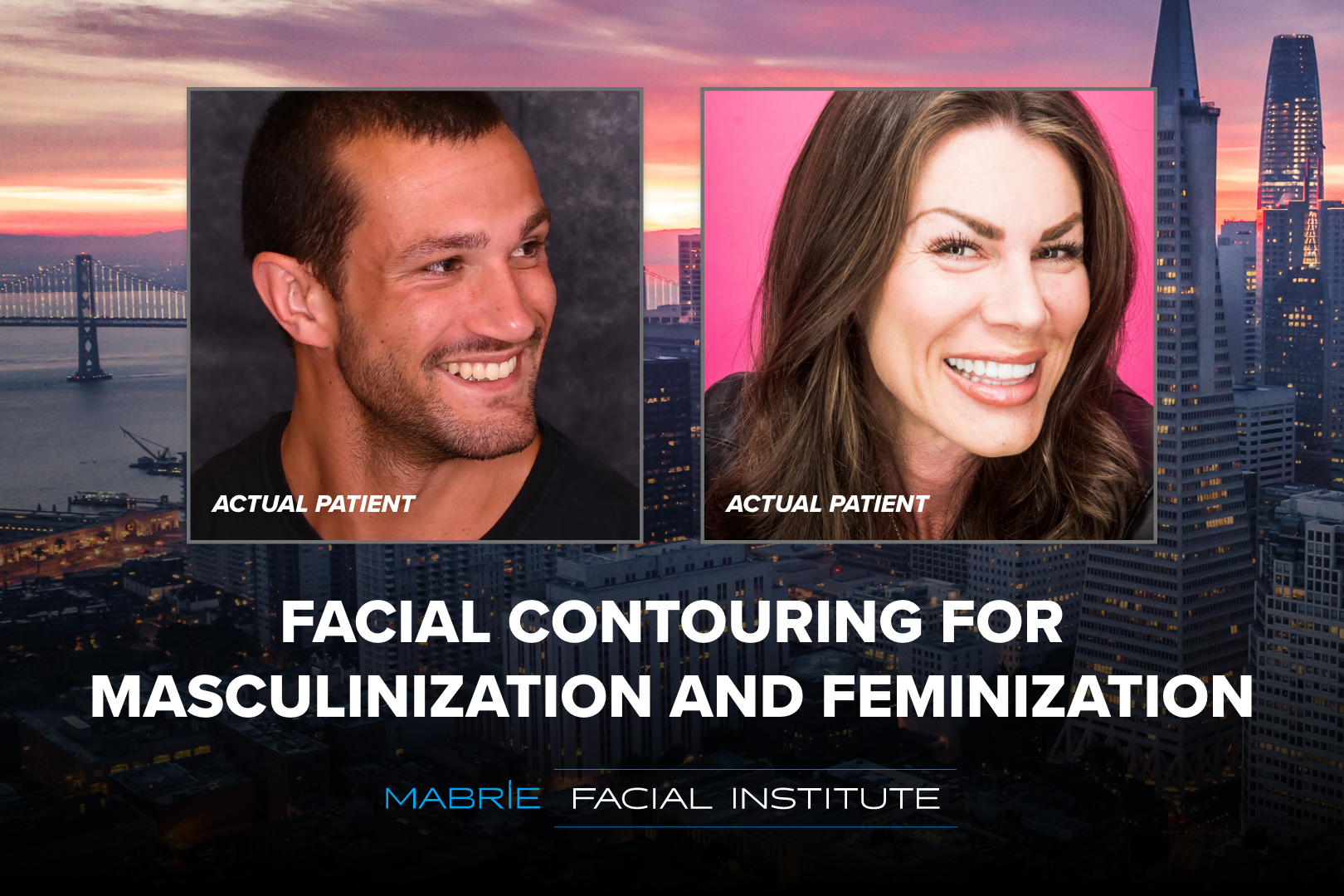 Chin & Jawline Fillers & BOTOX: A Guide to Facial Contouring for ...